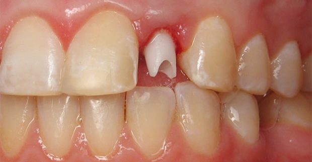 Montana Roots Dental Care | Top Quality Care For Your Smile